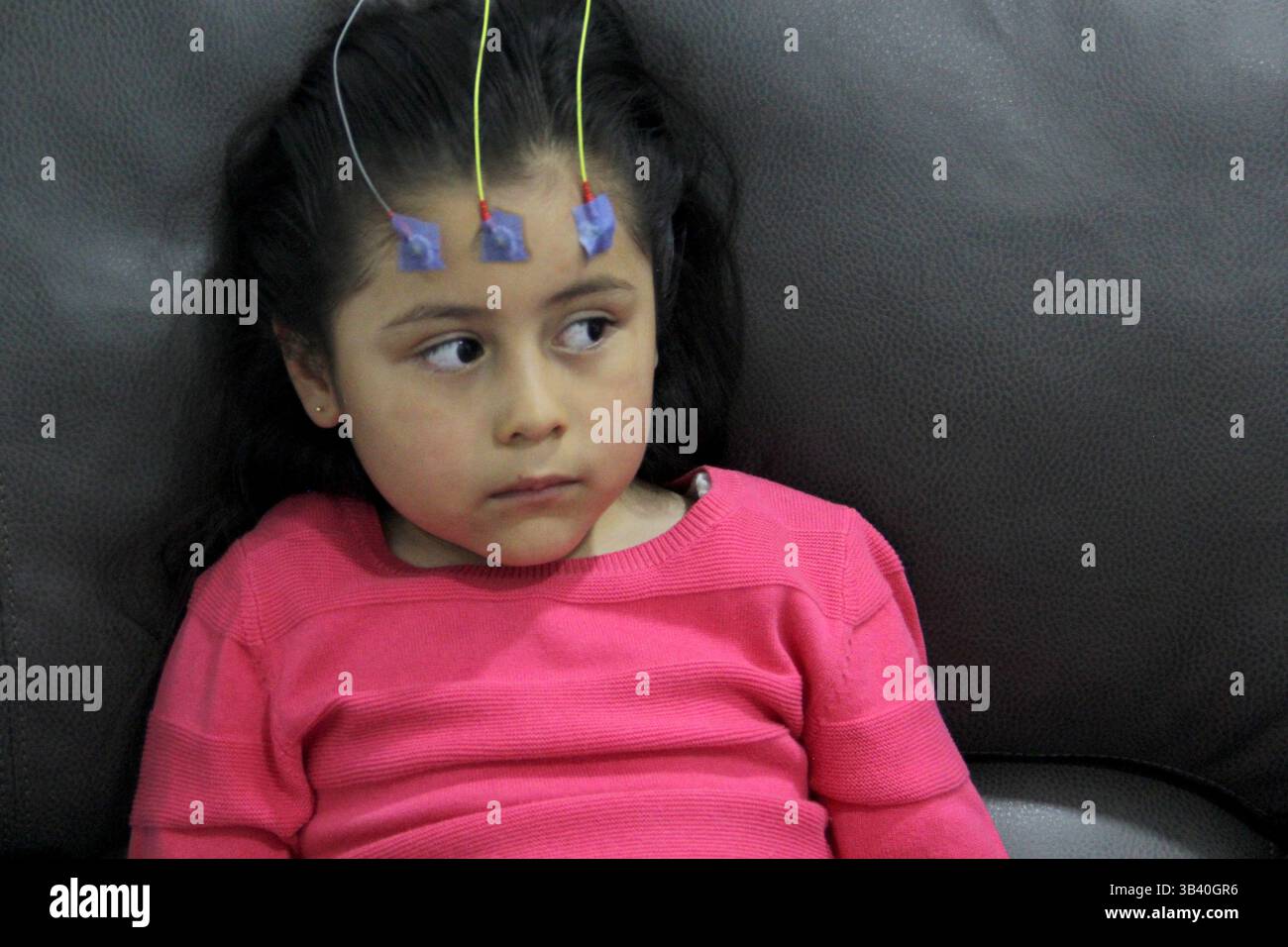 Electroencephalogram, a test that measures the brain's electrical ...