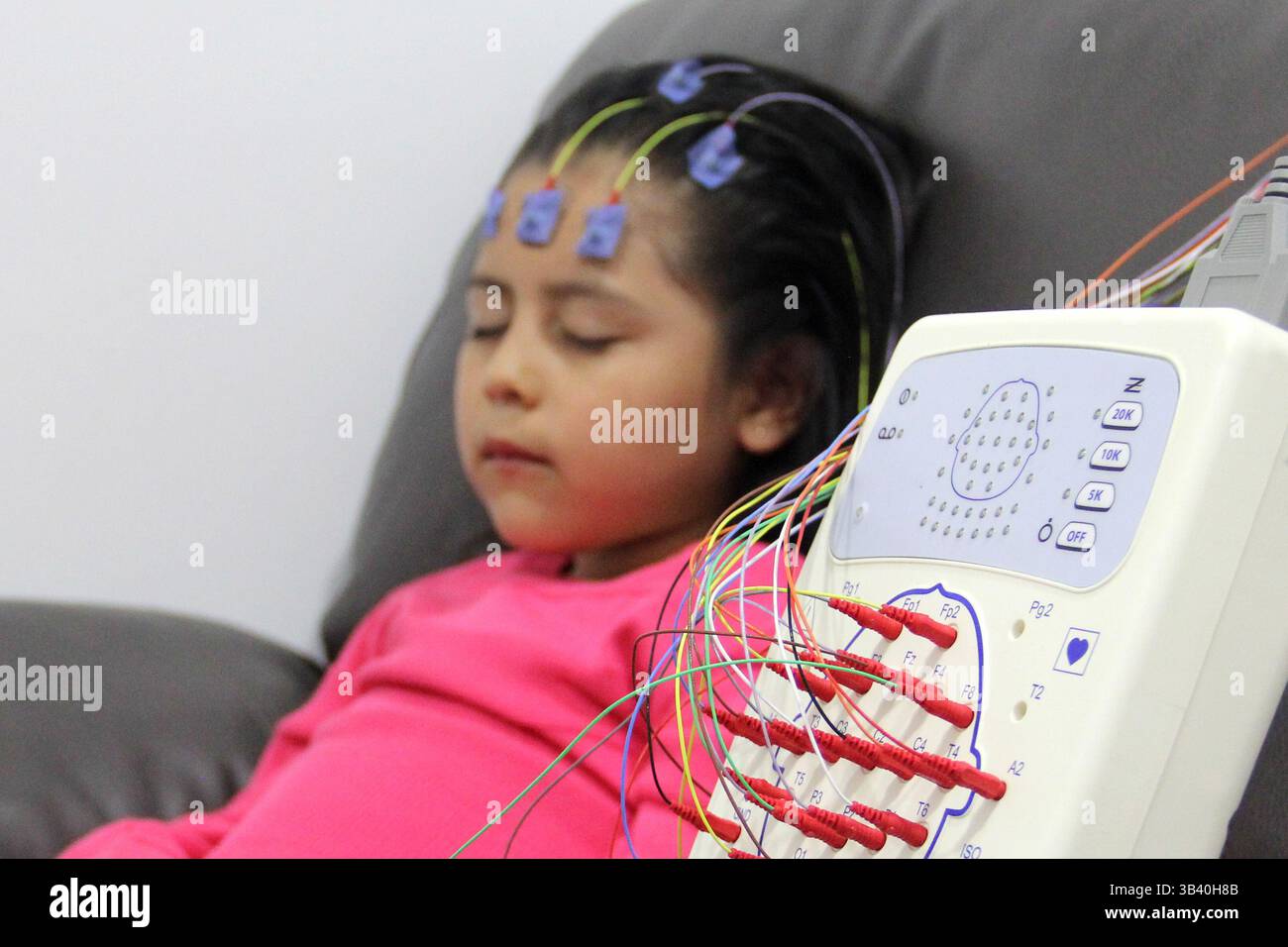 Electroencephalogram, a test that measures the brain's electrical ...