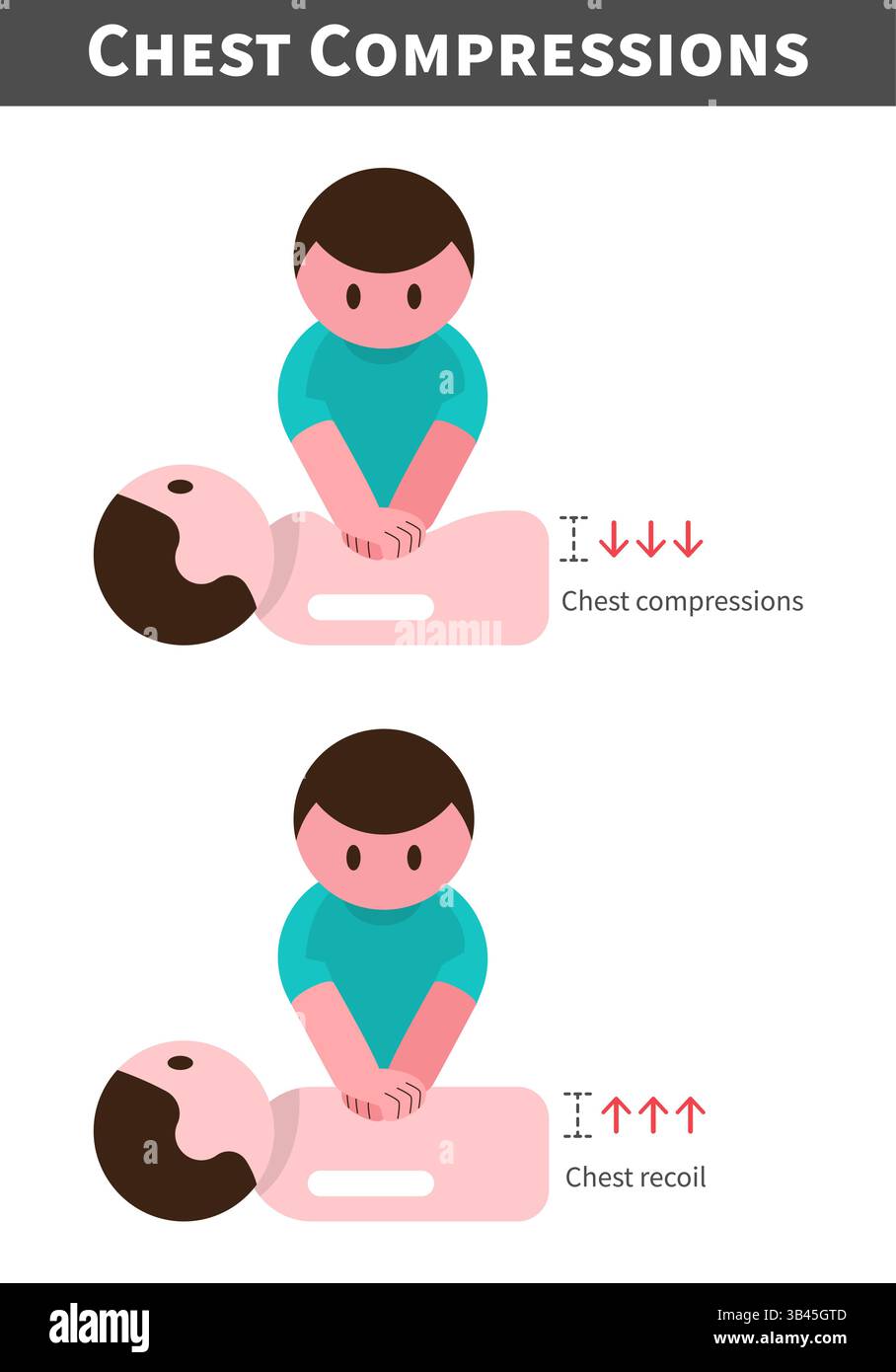 CPR . Cardiopulmonary resuscitation . Procedure of chest compressions . Flat design cartoon ...