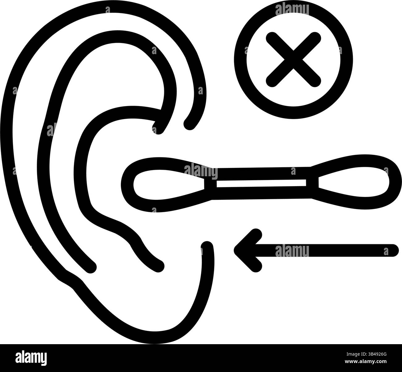 Ear wax in the auditory canal Black and White Stock Photos & Images - Alamy