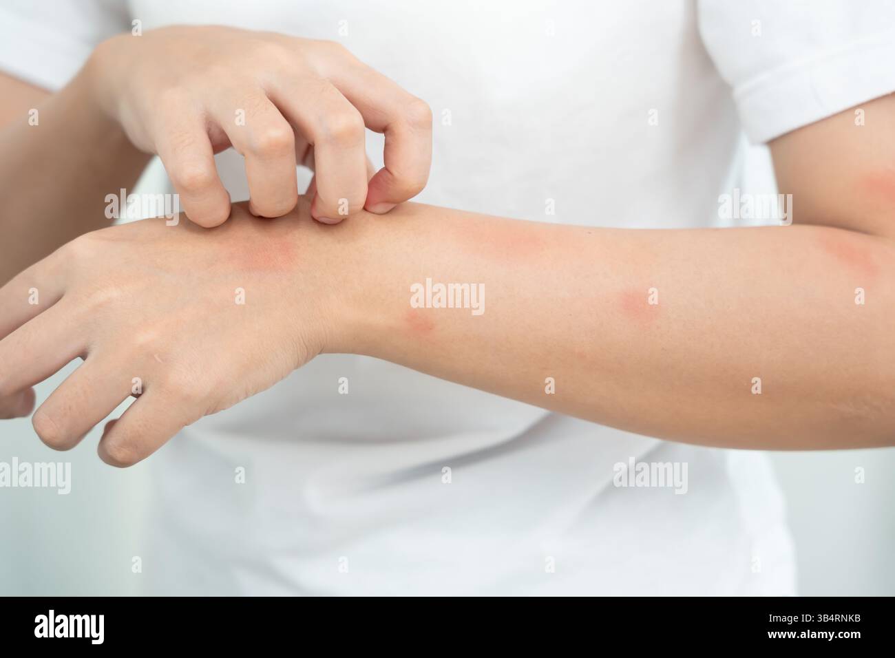 Skin and beauty problems: Women have itchy skin and red rashes from ...
