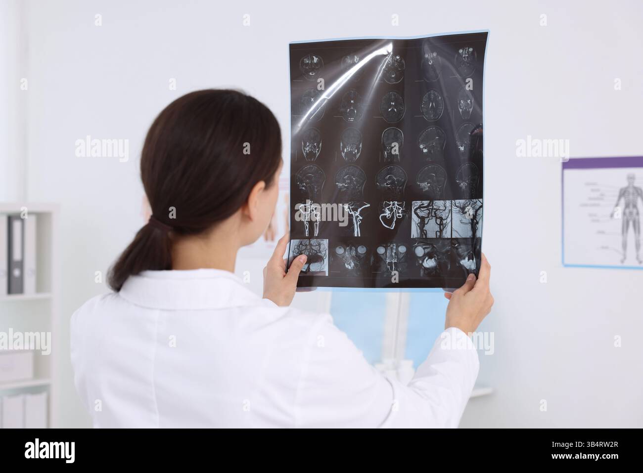 Doctor examining MRI scan in hospital, back view Stock Photo - Alamy