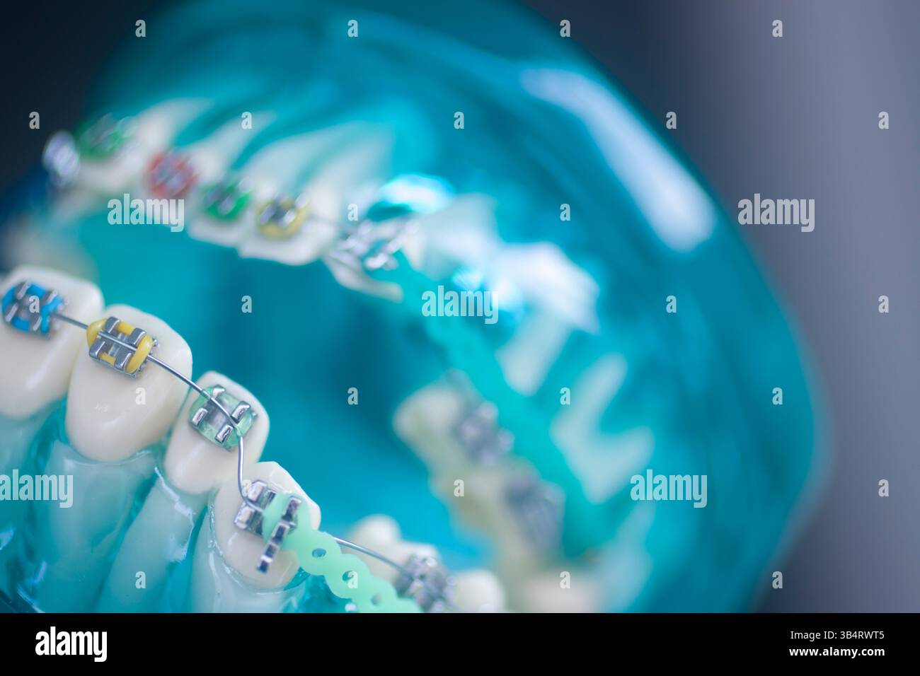 Dental teeth aligner bracket teaching student model showing gums and ...