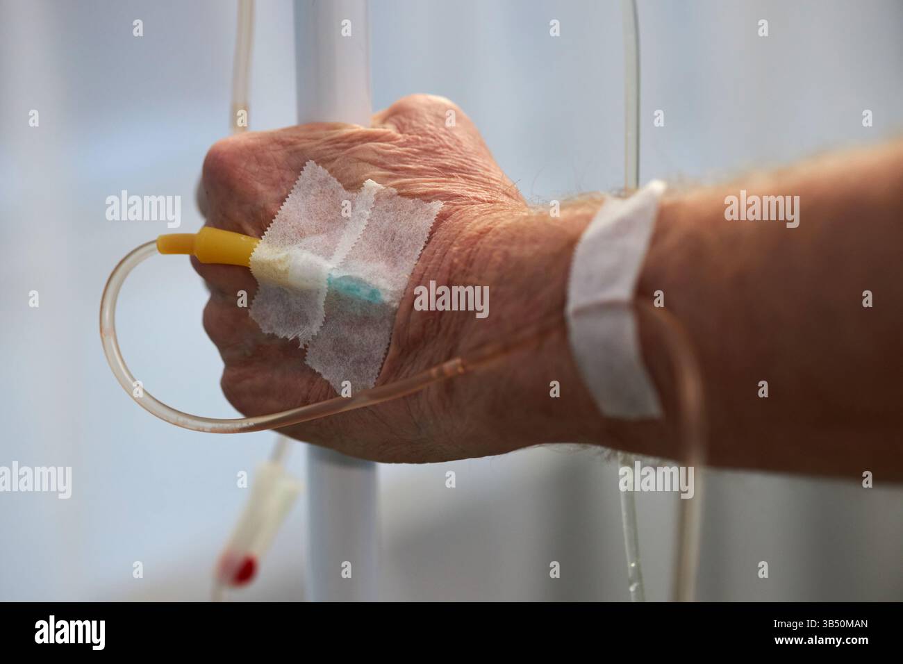 Hospital wrist band hand medical hi-res stock photography and images ...