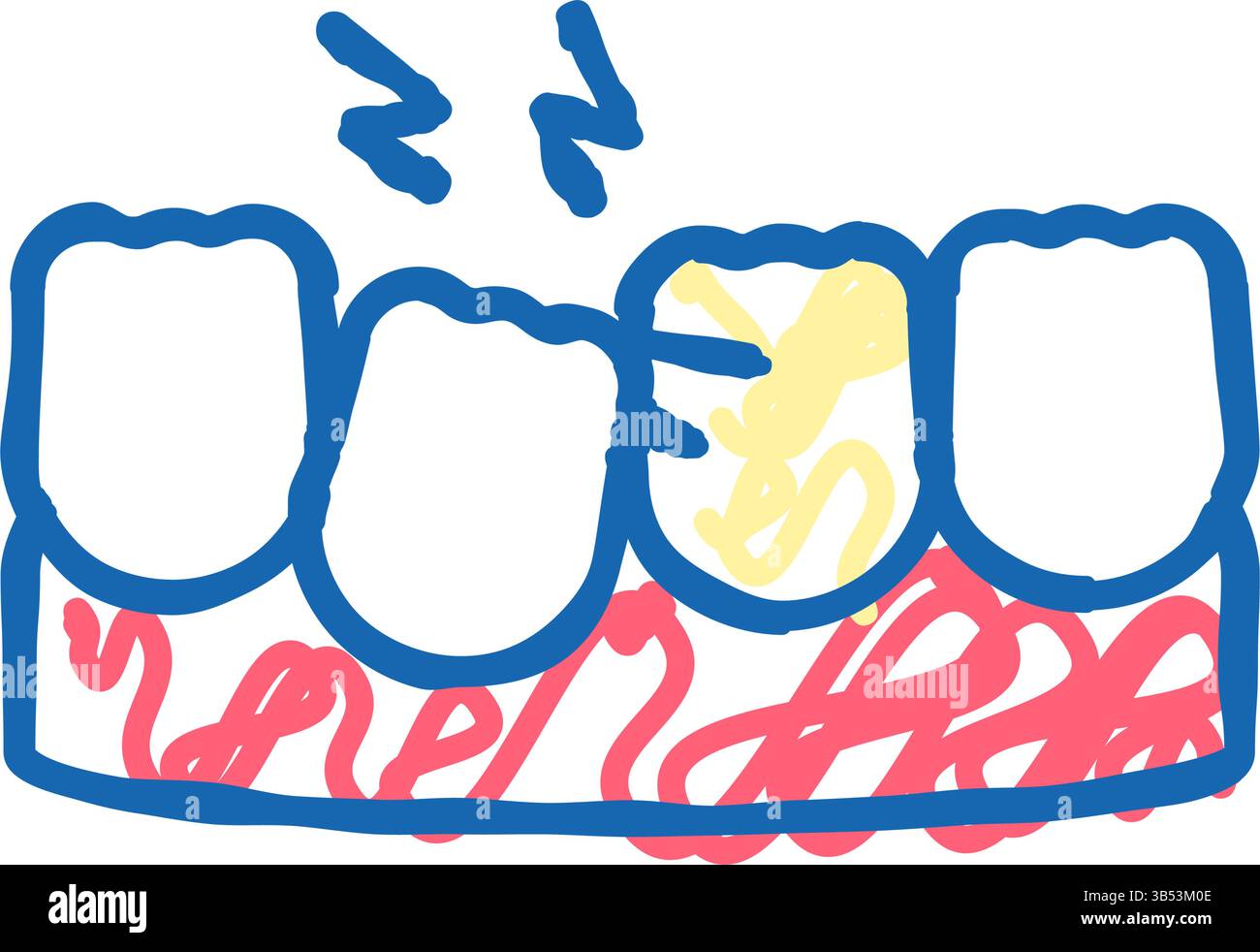 Loose teeth Stock Vector Images - Alamy