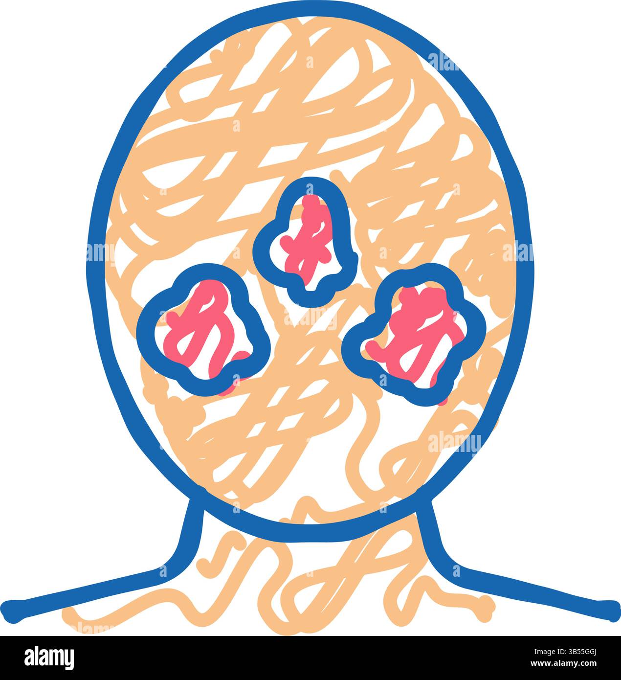 rosacea skin disease icon doodle illustration Stock Vector Image & Art ...