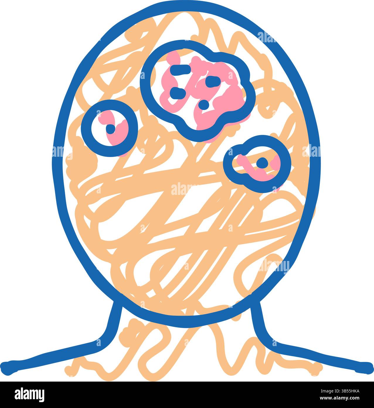 seborrhoeic dermatitis skin disease icon doodle illustration Stock ...
