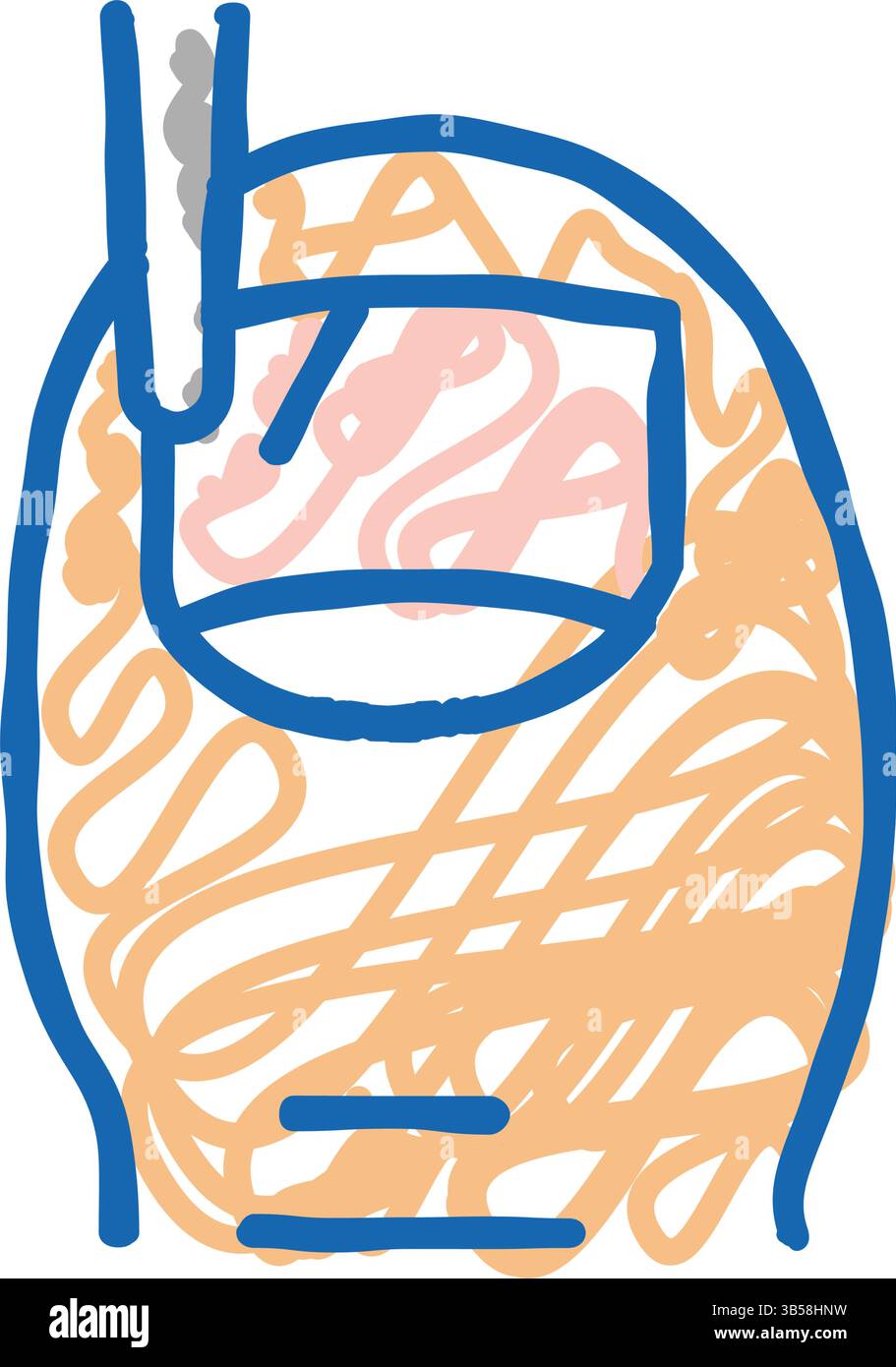 surgical intervention medical therapy icon doodle illustration Stock ...
