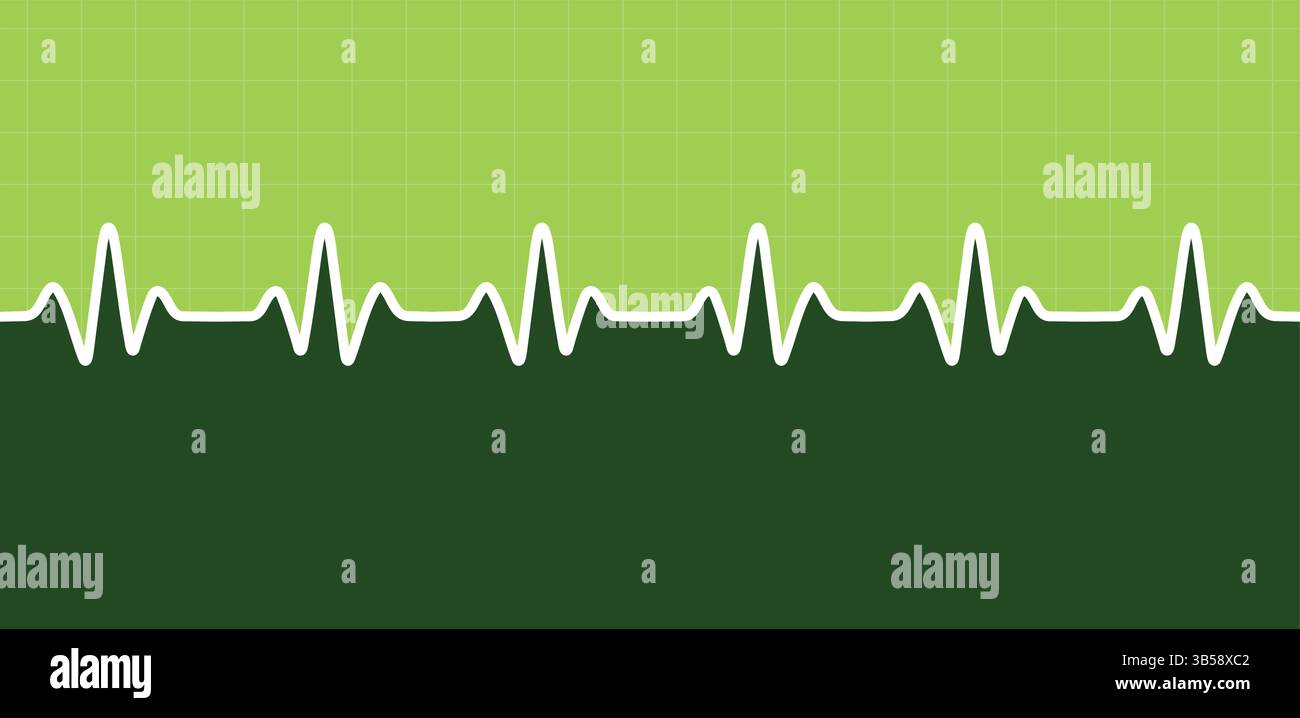 Electrocardiogram on a green background vector illustration. Heartbeat ...