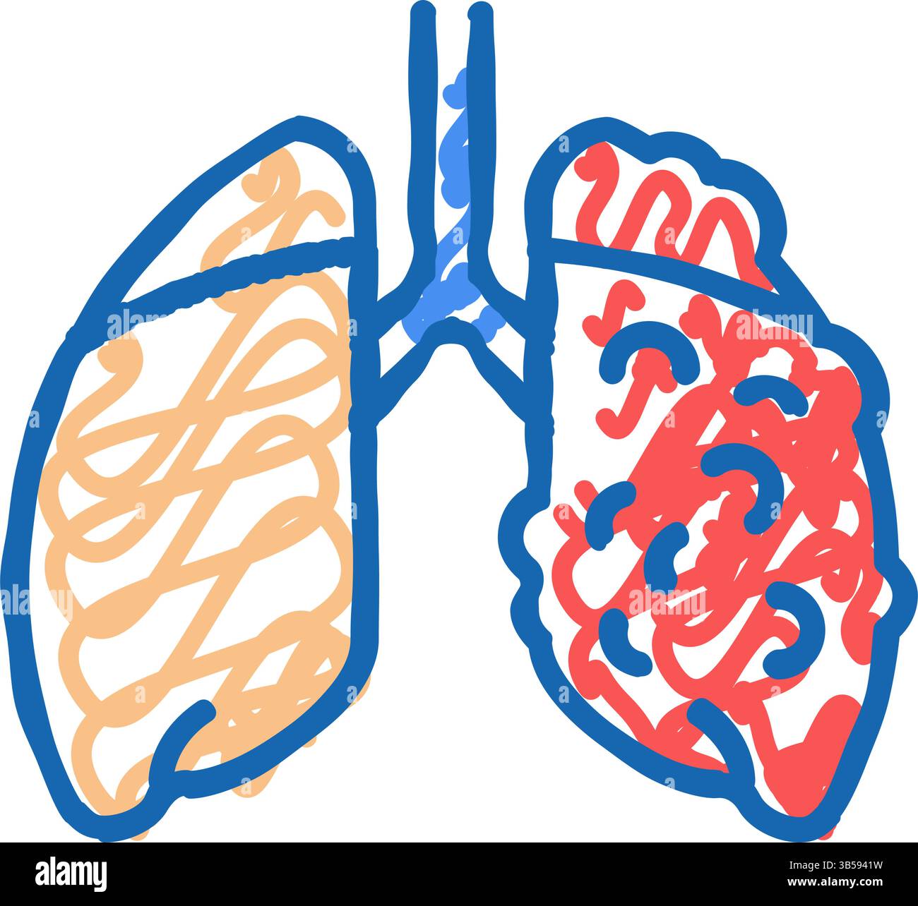 Ards respiratory disease color hi-res stock photography and images - Alamy