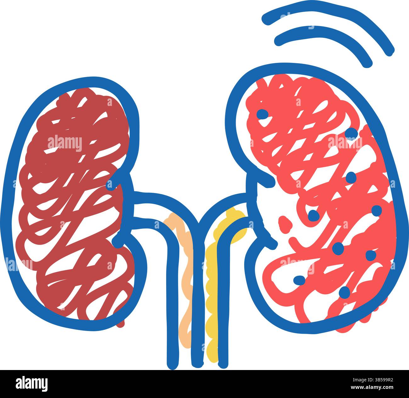 cancer kidney icon doodle illustration Stock Vector Image & Art - Alamy