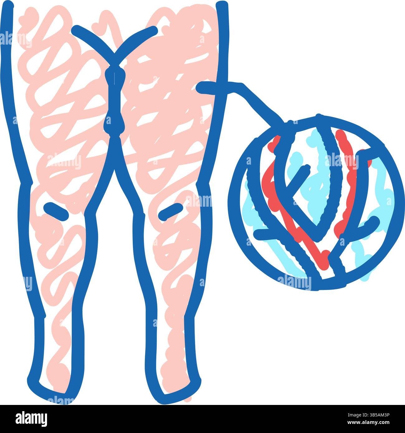 lymphatic edema icon doodle illustration Stock Vector Image & Art - Alamy