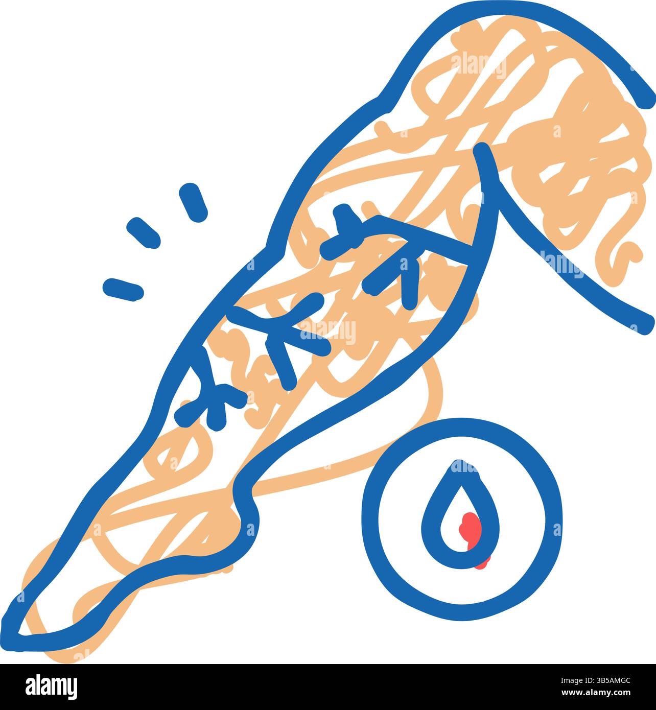 venous edema icon doodle illustration Stock Vector Image & Art - Alamy