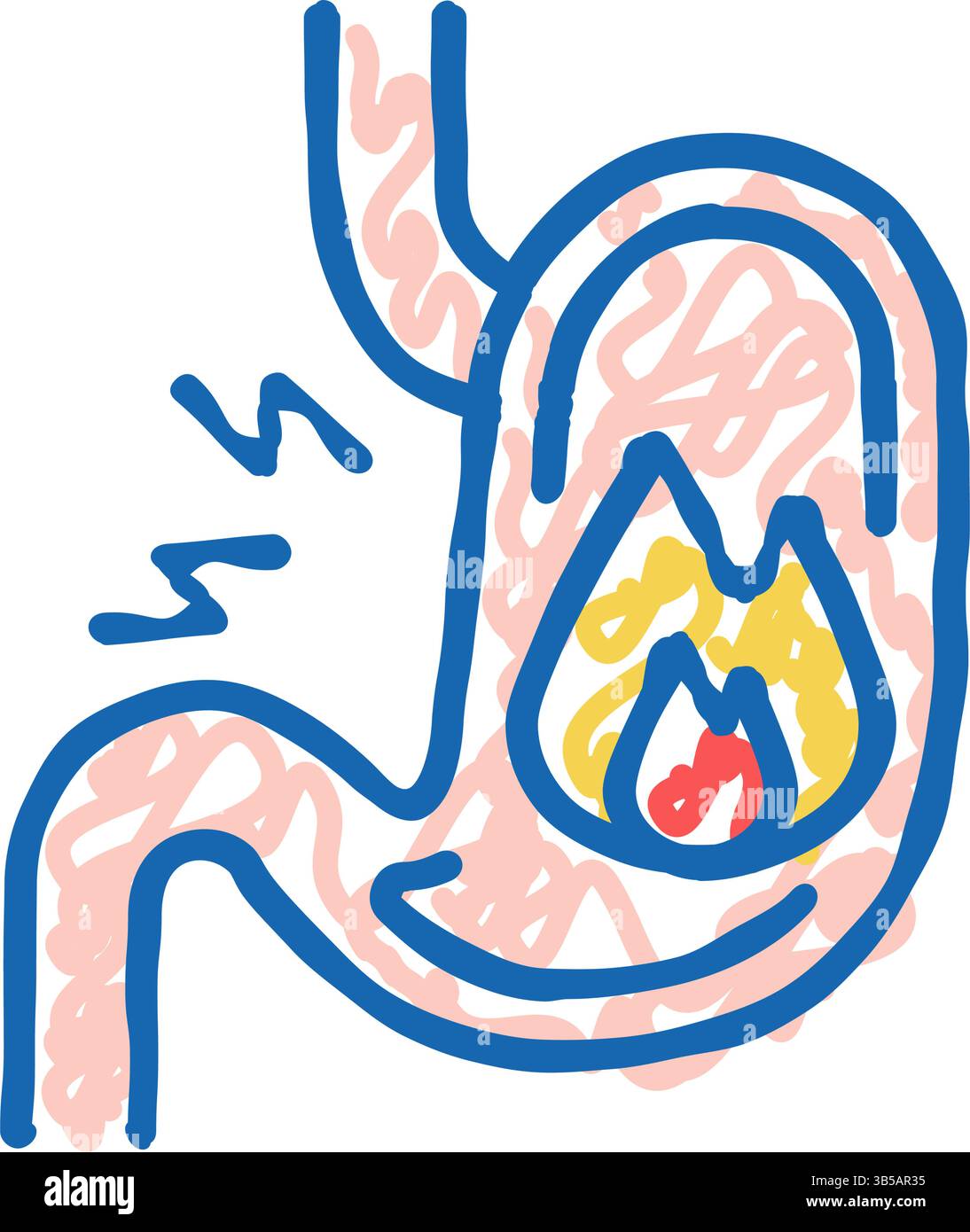 Treat heartburn Stock Vector Images - Alamy