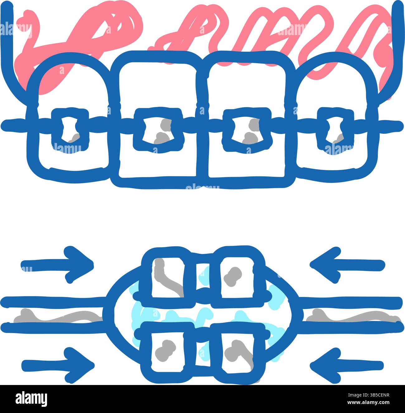 work process tooth braces icon doodle illustration Stock Vector Image ...