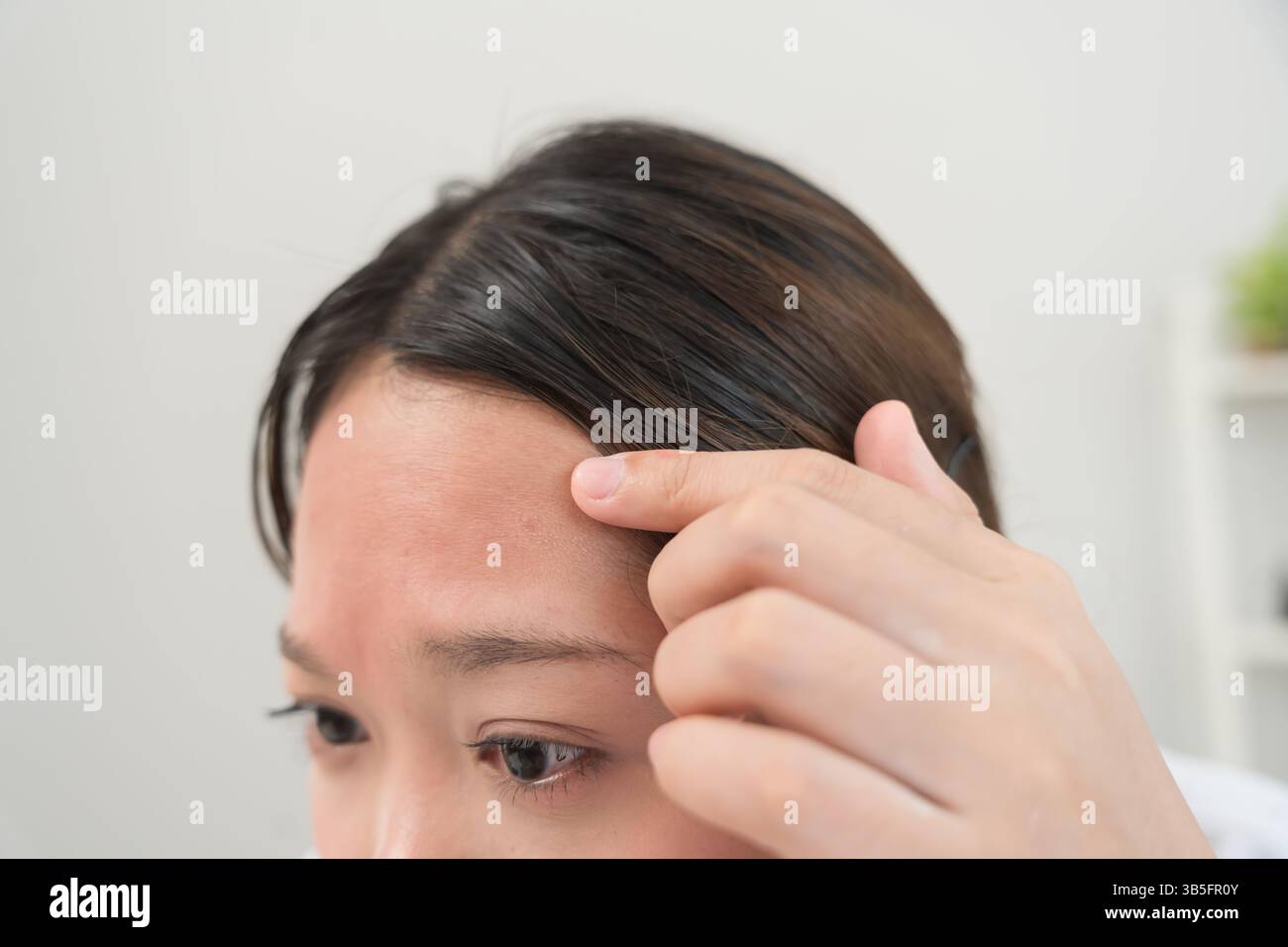 Woman worried about face Dermatology, rosacea dermatitis, allergic ...