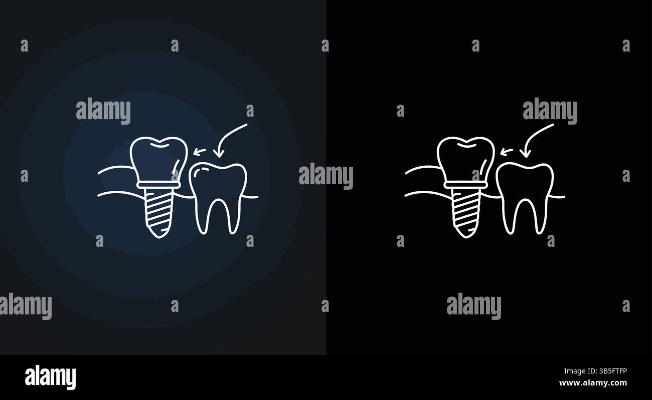 Dental Implant vs. Natural Tooth Comparison Stock Vector Image & Art ...