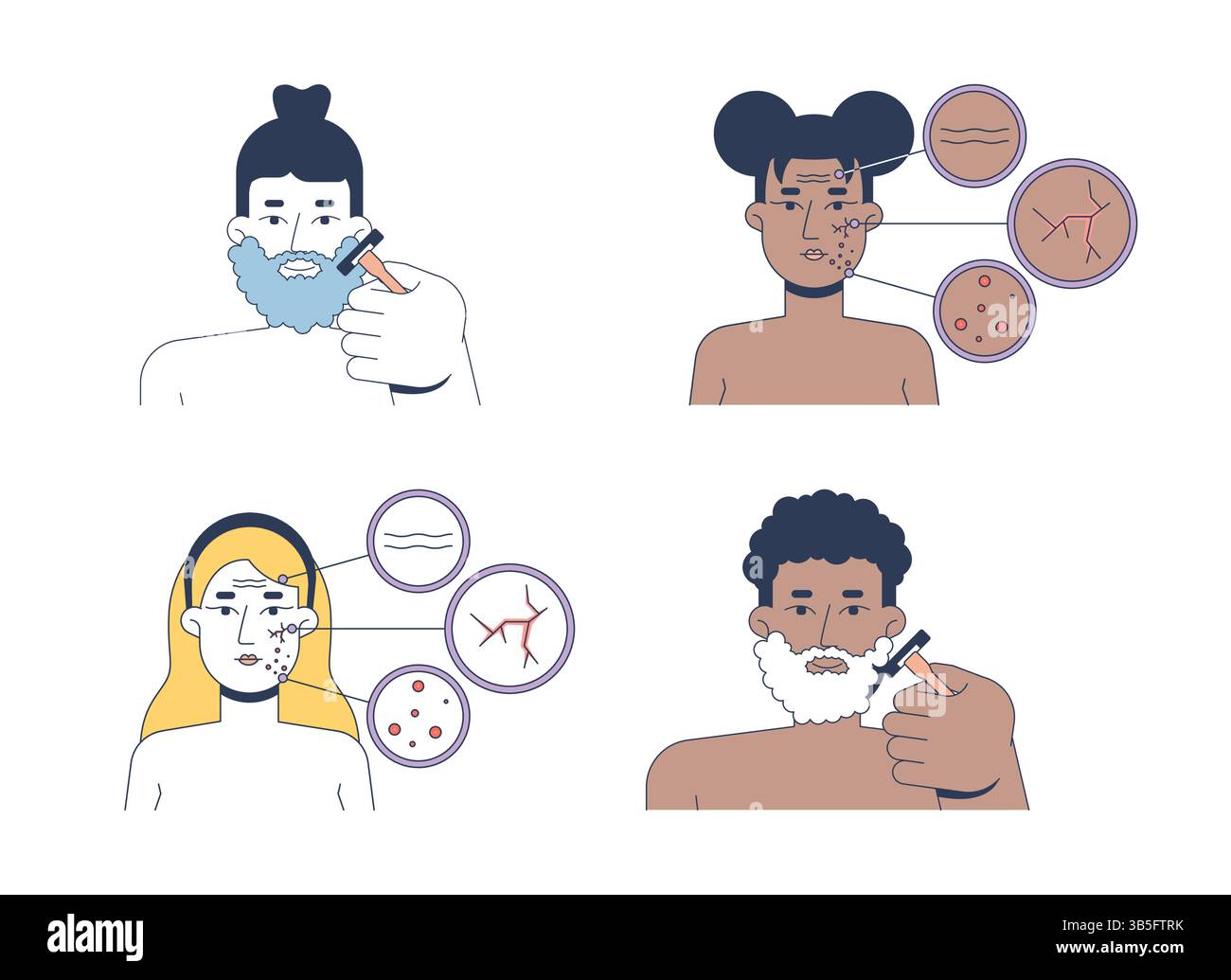 Face skin problems and shaving routine 2D vector illustrations set ...