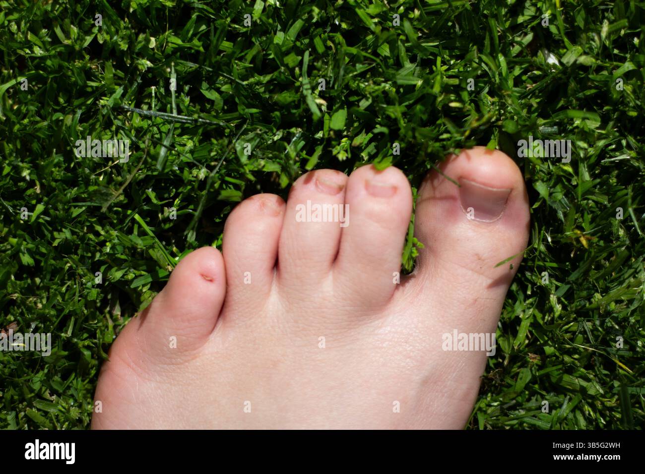 Foot with small toes and a small pinky nail Stock Photo - Alamy