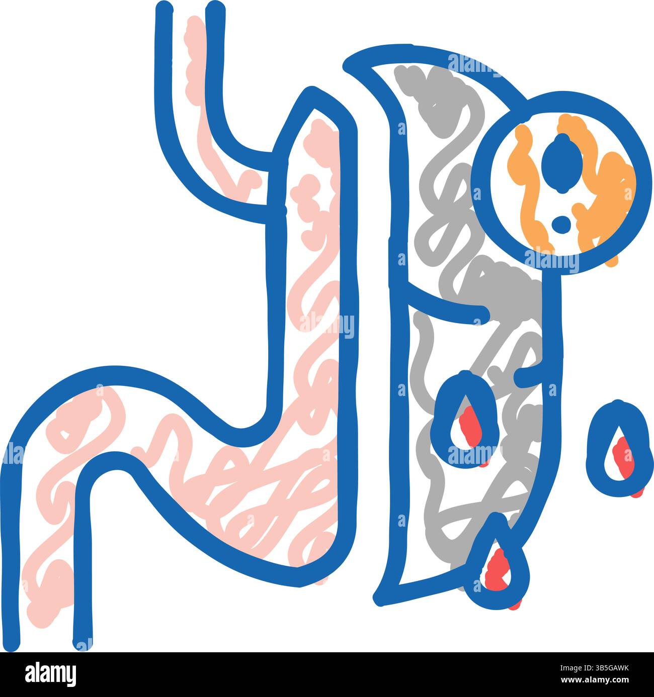 risk of complications, severe bleeding icon doodle illustration Stock ...