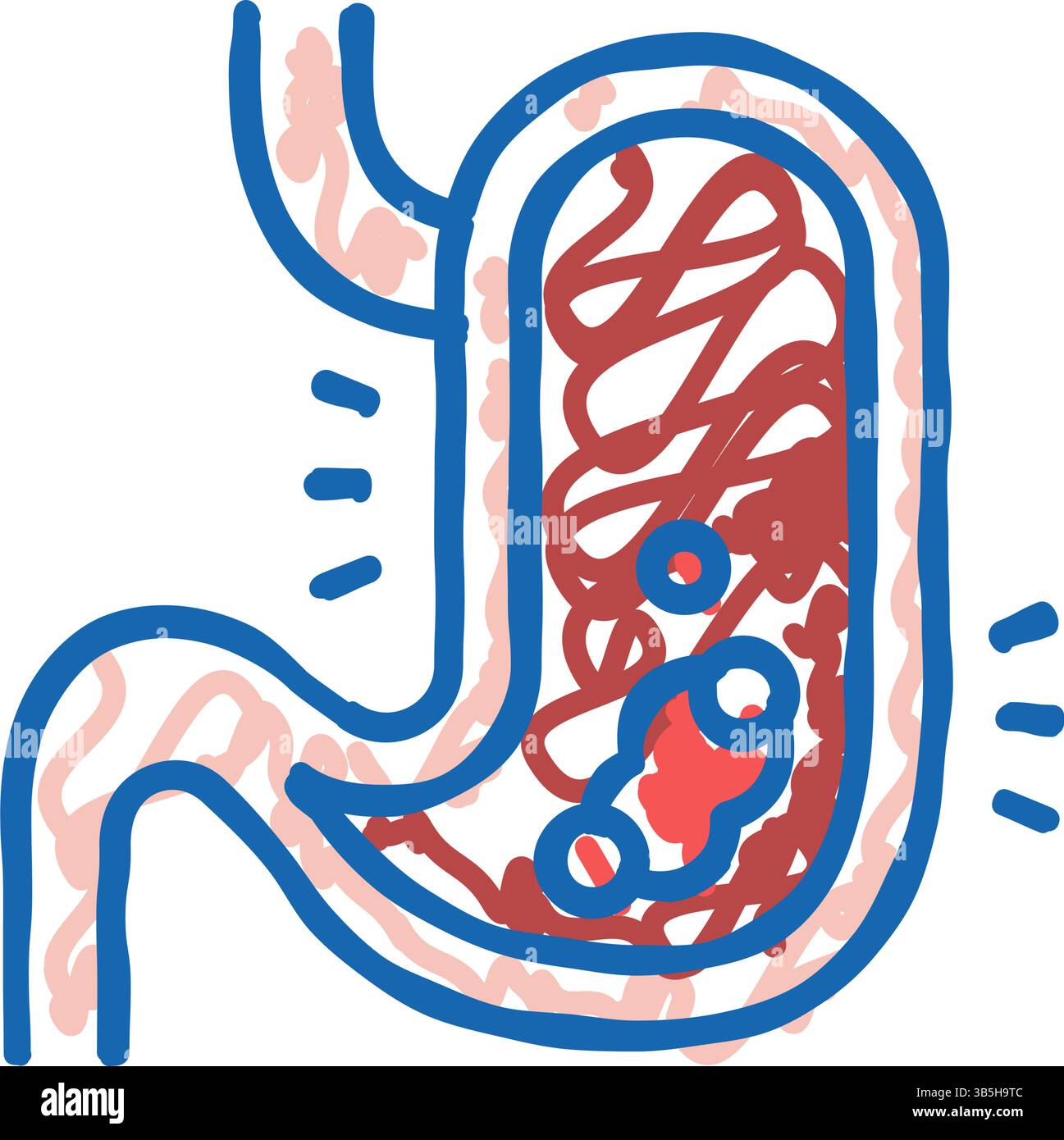 gastric disease icon doodle illustration Stock Vector Image & Art - Alamy