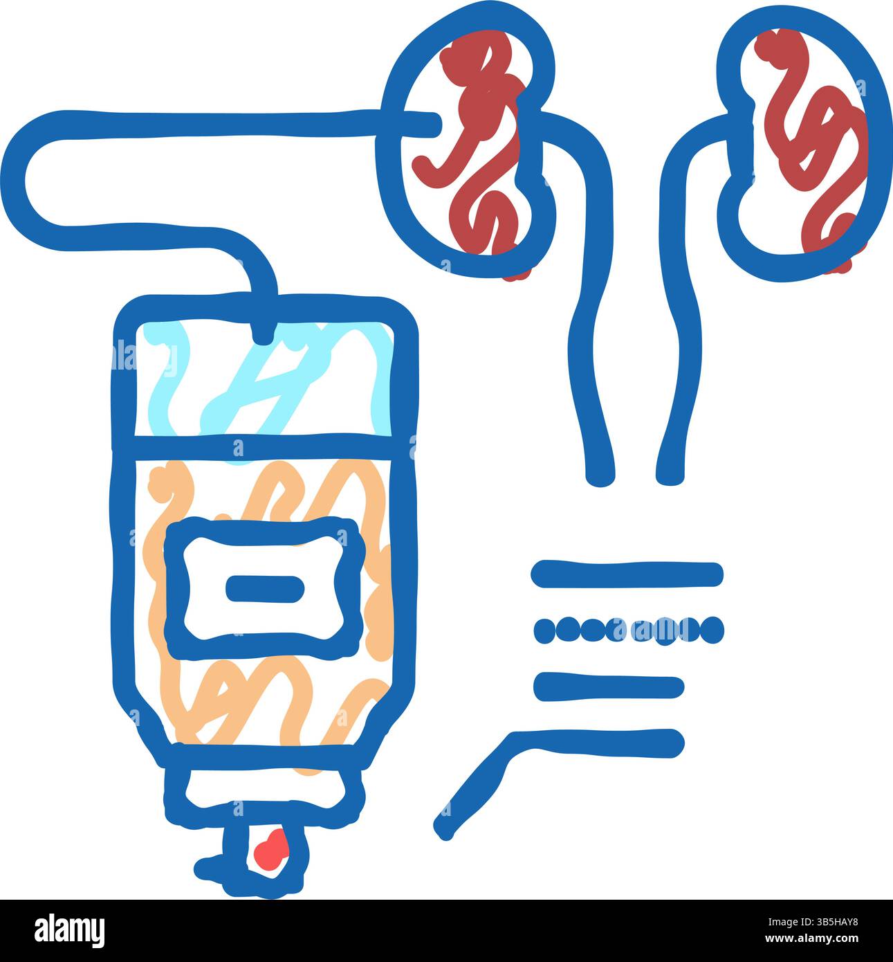 Nephrostomy hi-res stock photography and images - Alamy