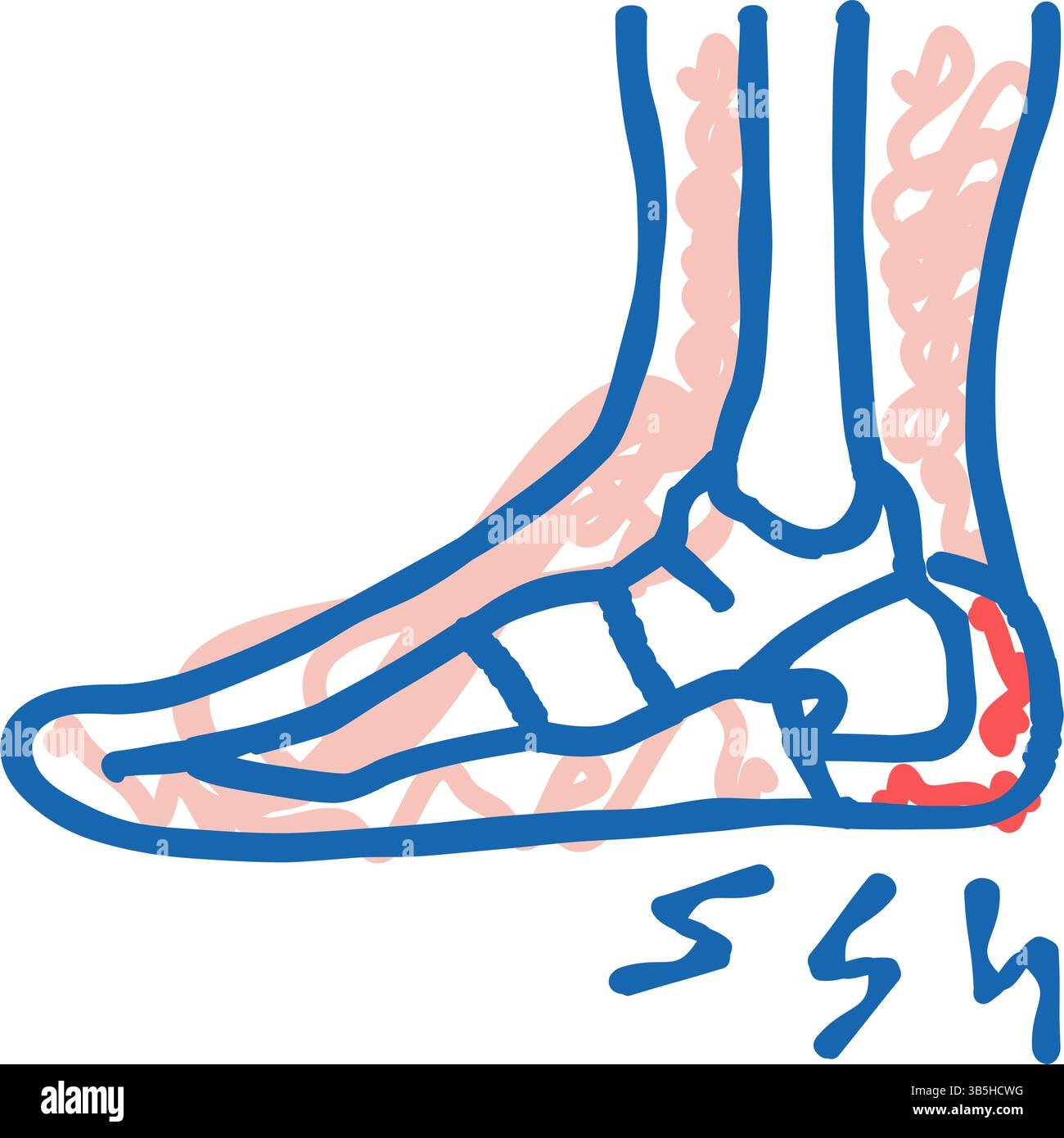 Heel spur disease icon hi-res stock photography and images - Alamy