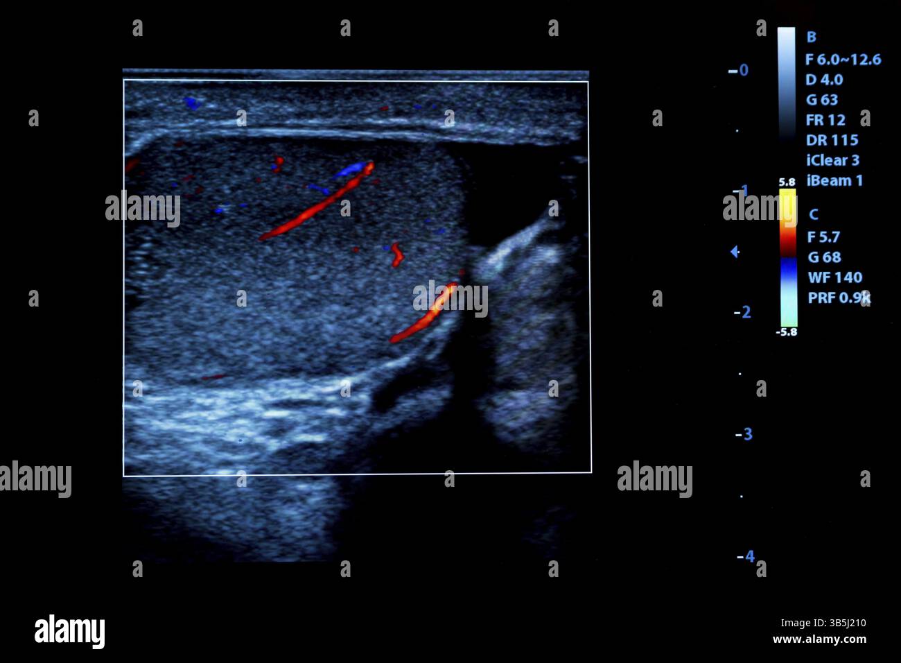 Colourful image of modern ultrasound monitor. Ultrasonography machine ...