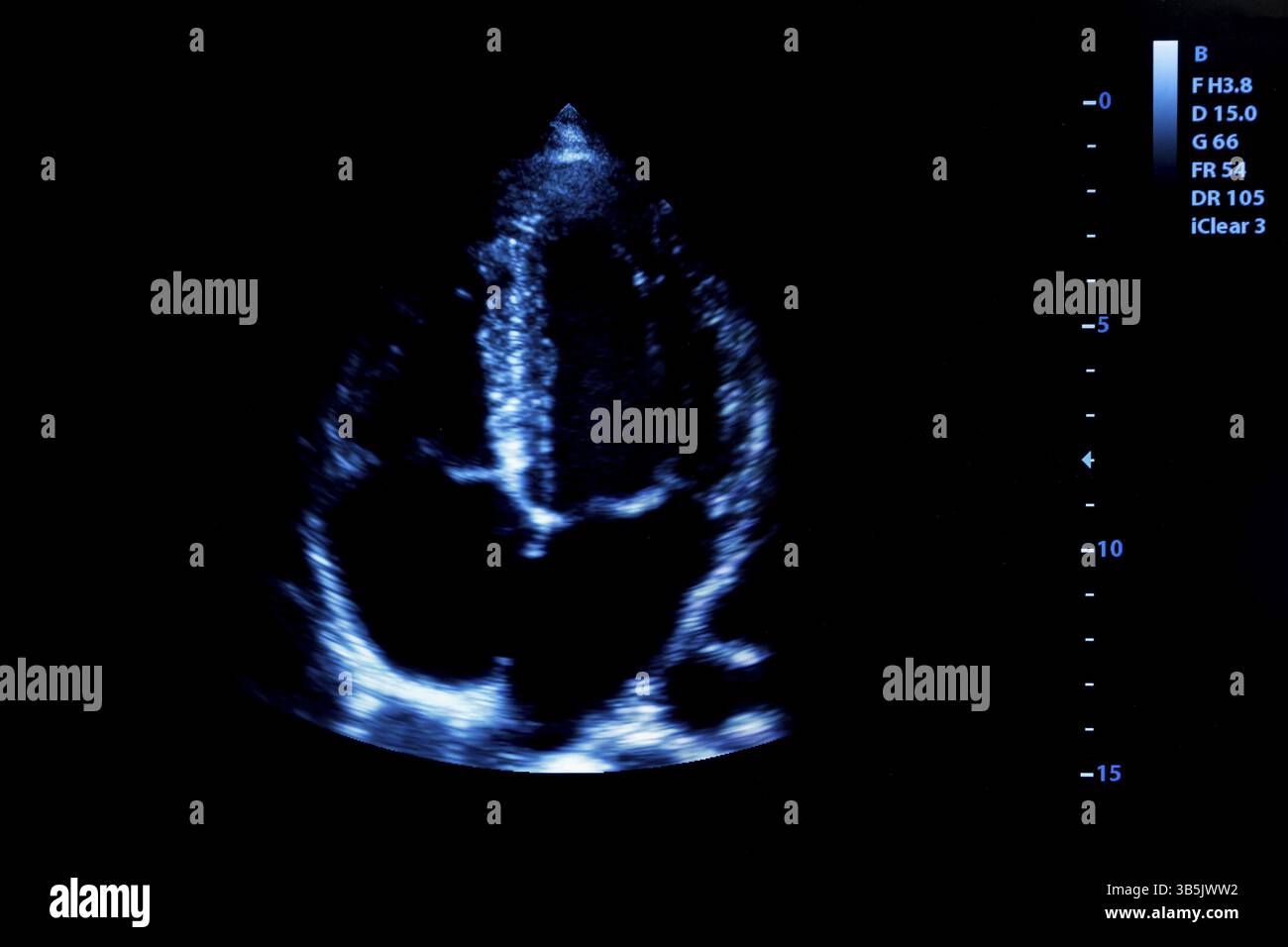 Colourful image of modern ultrasound monitor. Ultrasonography machine ...