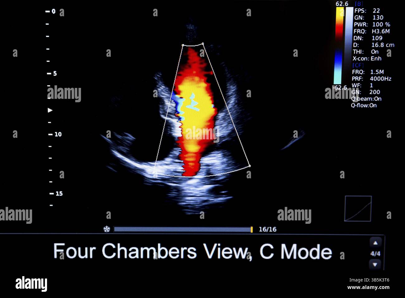 Colourful image of modern ultrasound monitor. Ultrasonography machine ...