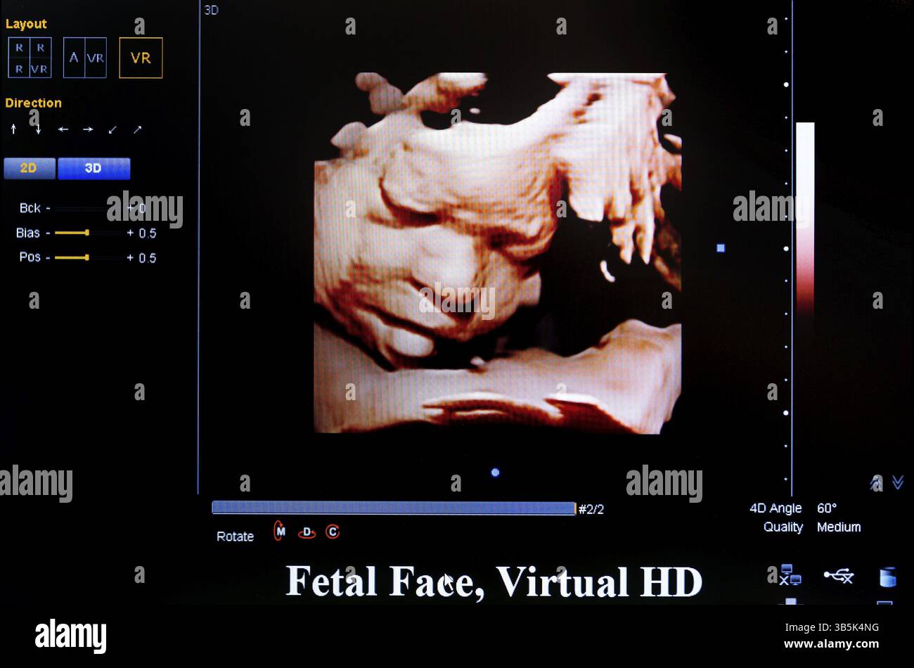 Modern echocardiography (ultrasound) machine monitor. Colour image. New ...