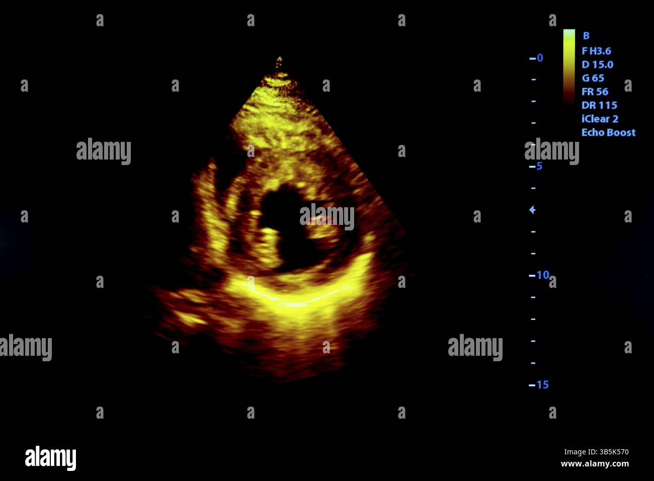 Colourful image of modern ultrasound monitor. Ultrasonography machine ...