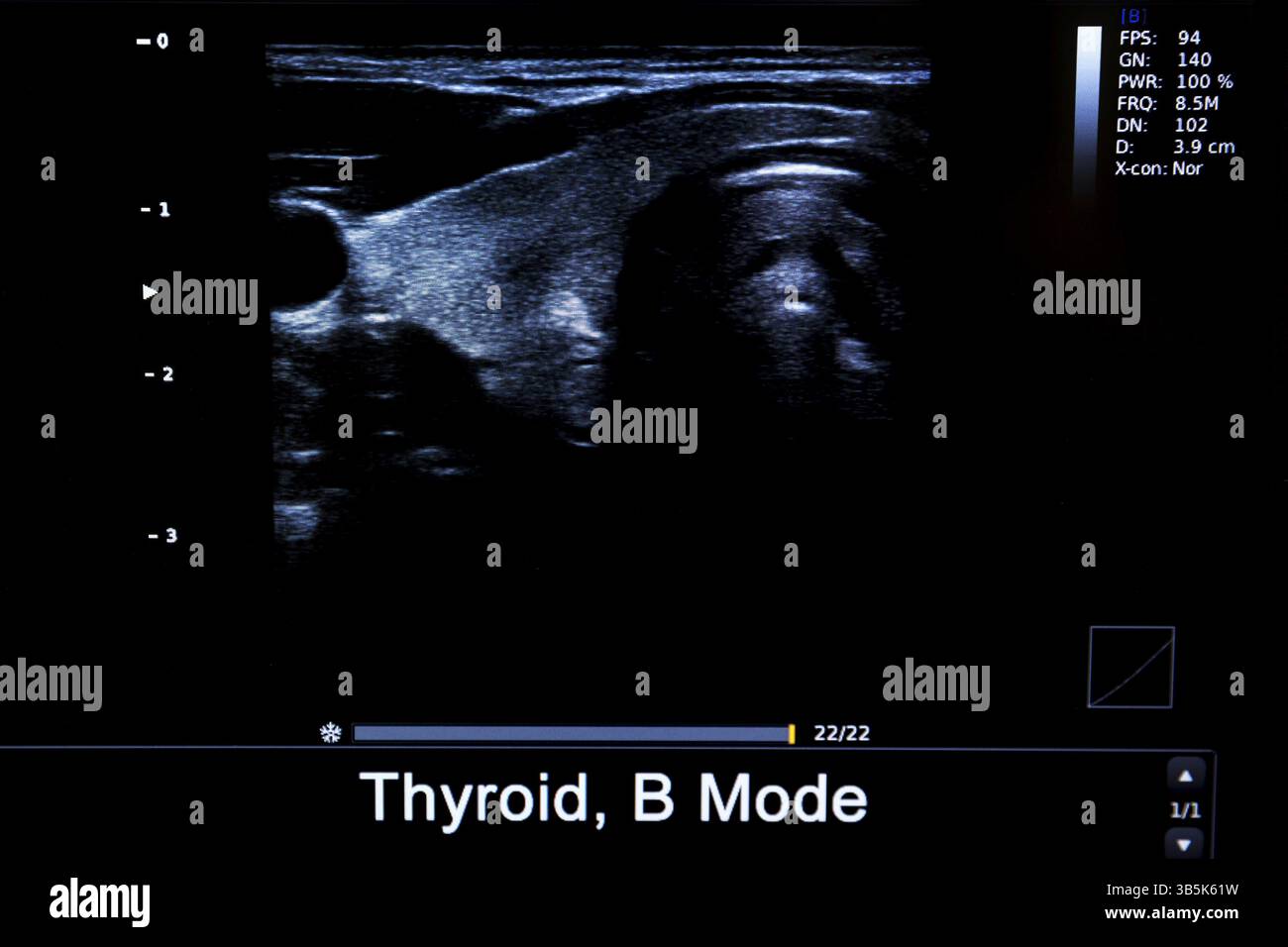 Colourful image of modern ultrasound monitor. Ultrasonography machine ...
