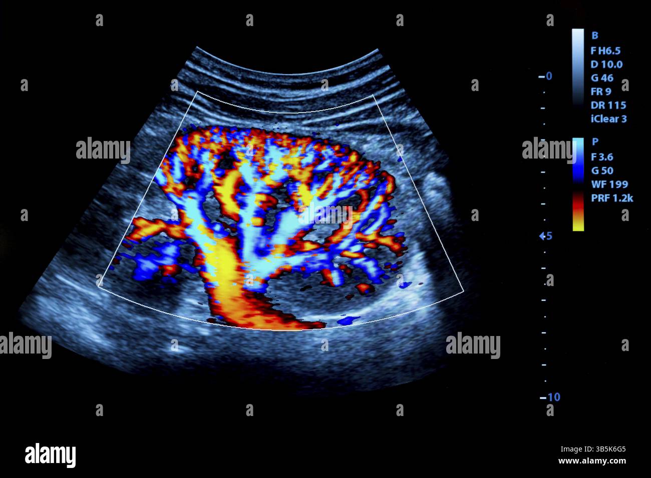 Colourful image of modern ultrasound monitor. Ultrasonography machine ...