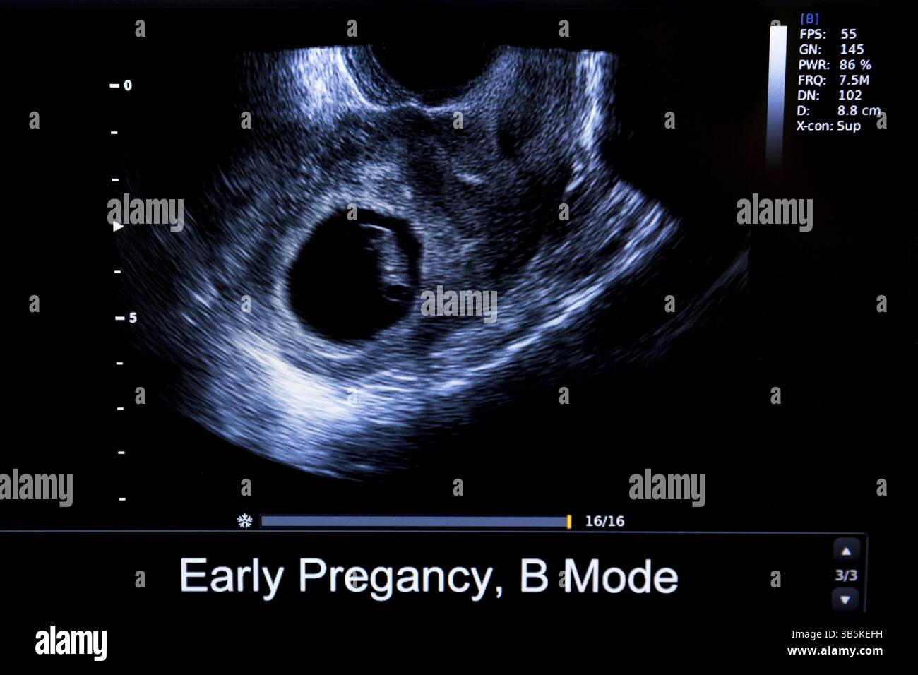 Colourful image of modern ultrasound monitor. Ultrasonography machine ...
