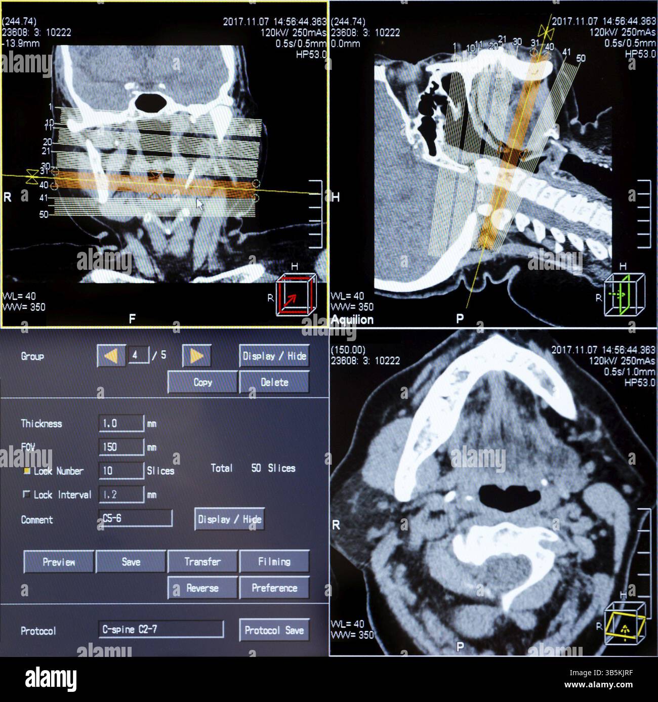 Magnetic resonance imaging (MRI) scan - CT scans of human head on a ...