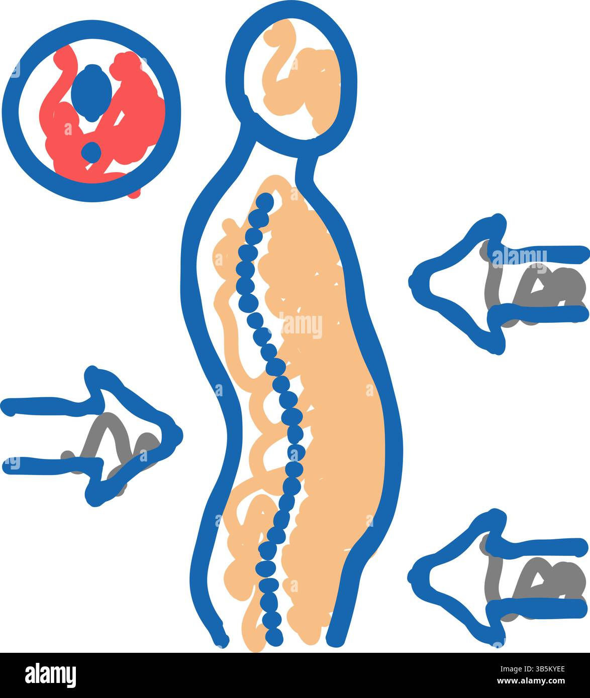 scoliosis disease icon doodle illustration Stock Vector Image & Art - Alamy