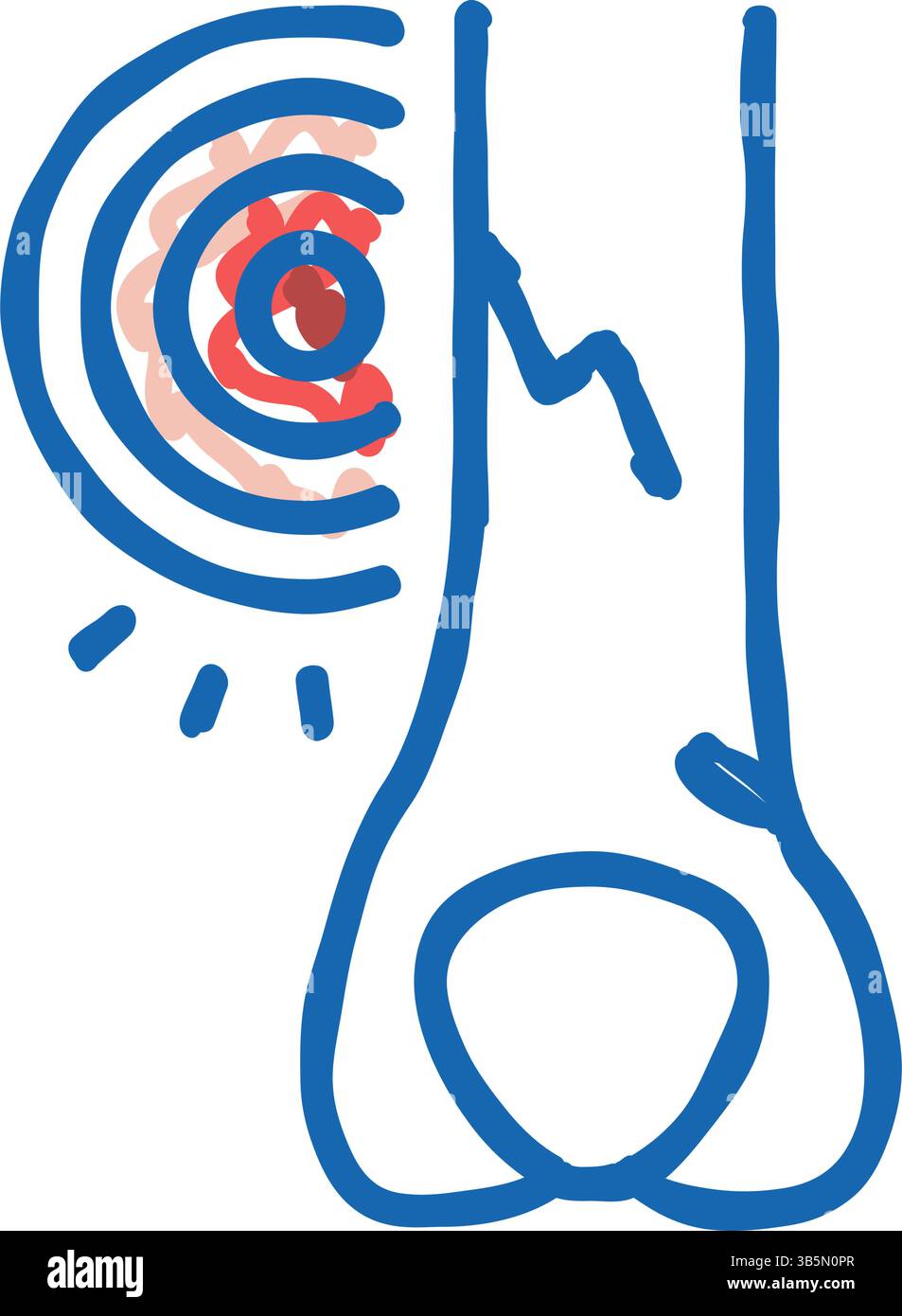 Open bone fracture icon Stock Vector Images - Alamy