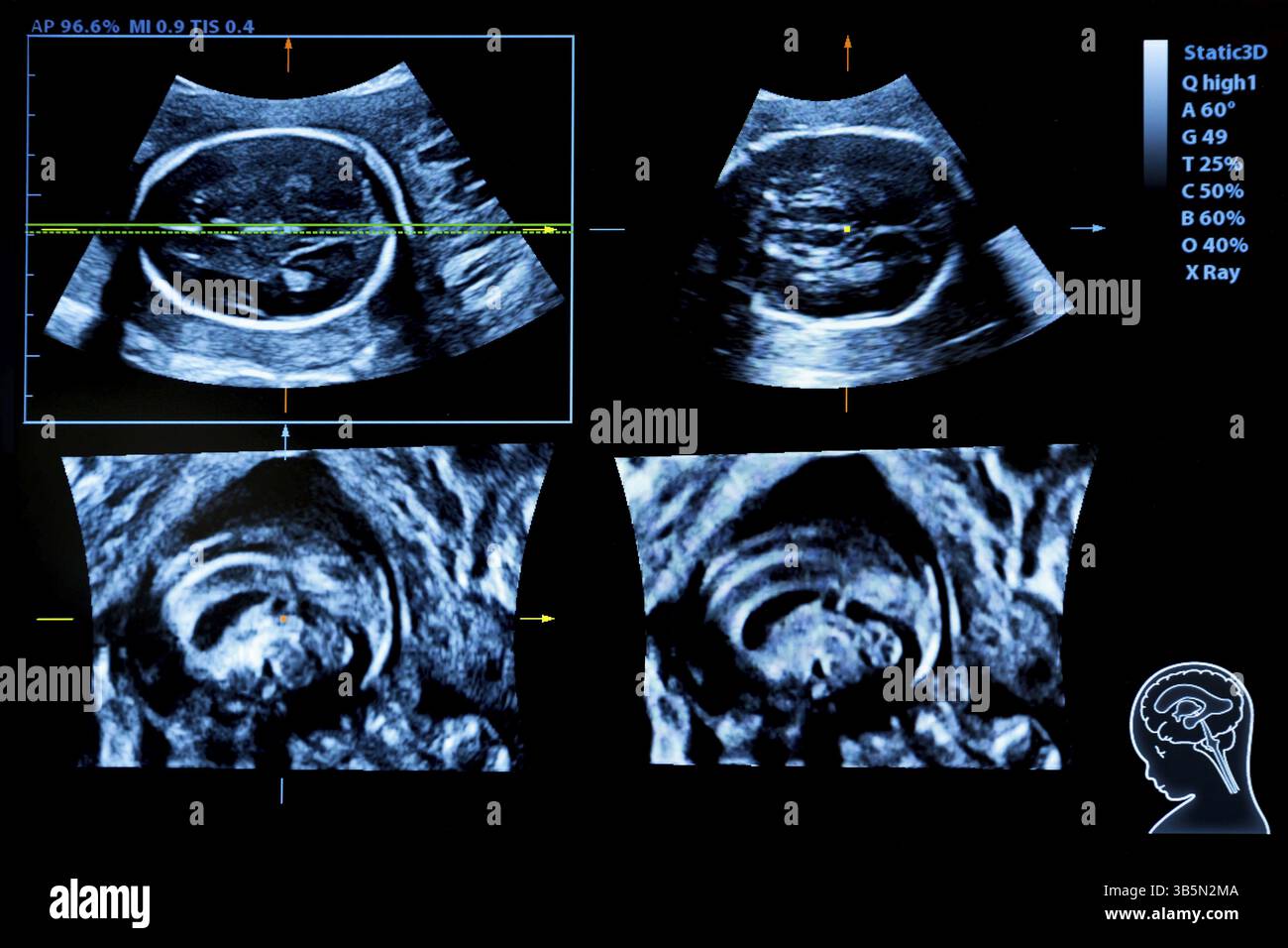 Colourful image of modern ultrasound monitor. Ultrasonography machine ...