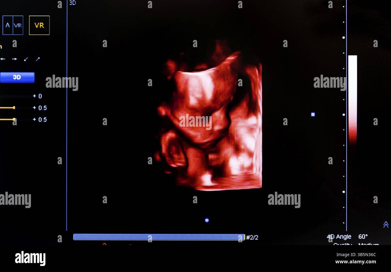 Modern echocardiography (ultrasound) machine monitor. Colour image. New ...