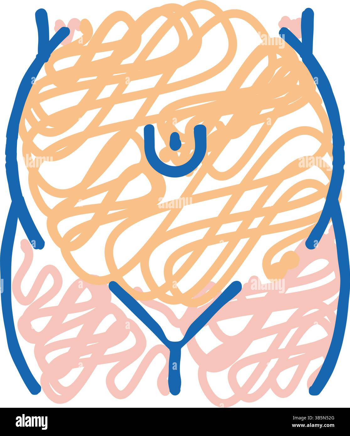 umbilical hernia disease icon doodle illustration Stock Vector Image ...