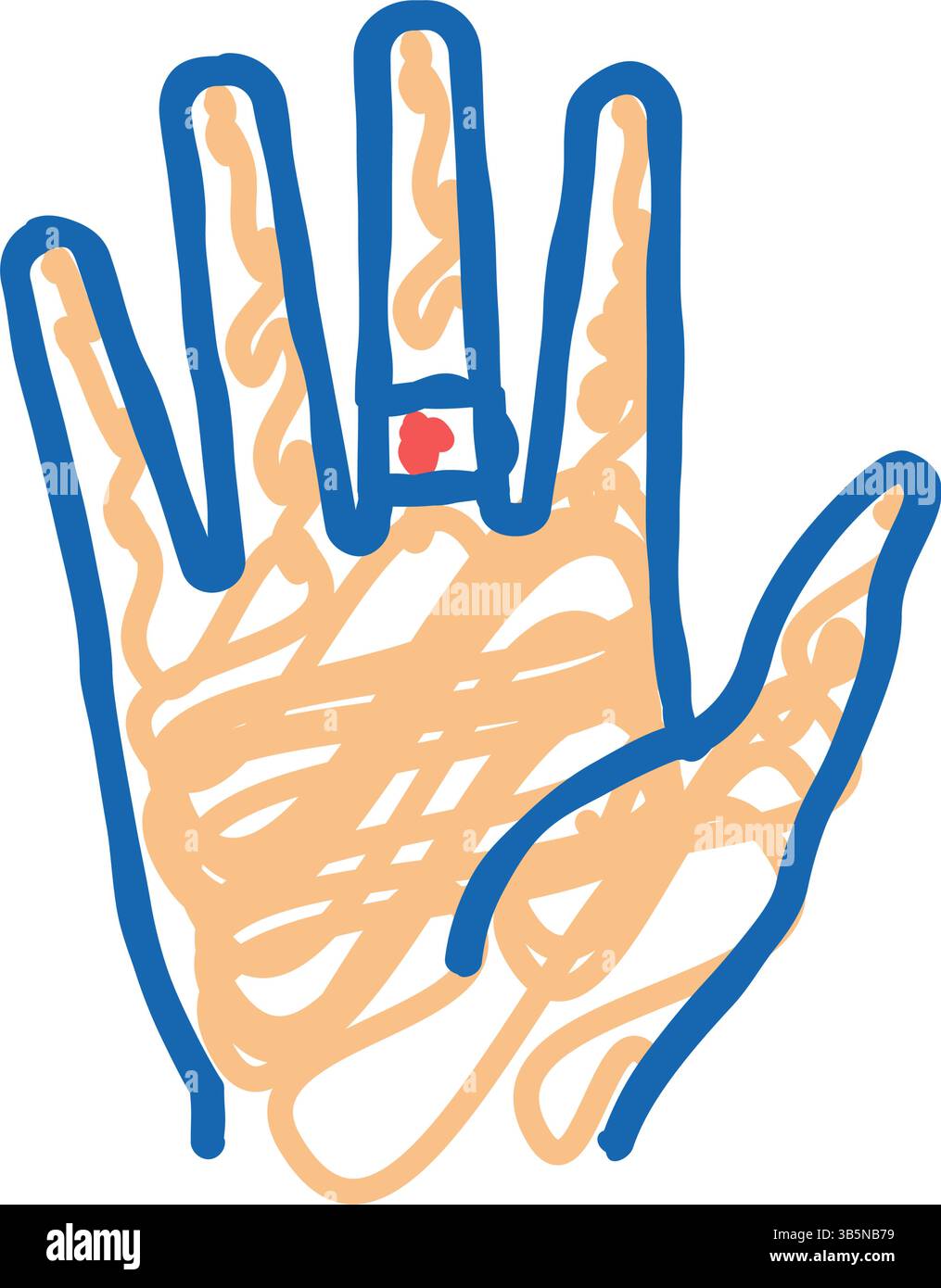 contact dermatitis icon doodle illustration Stock Vector Image & Art ...