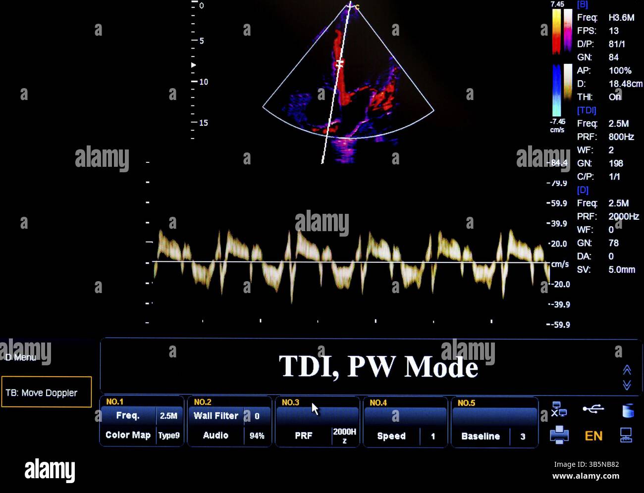 Modern echocardiography (ultrasound) machine monitor. Colour image. New ...