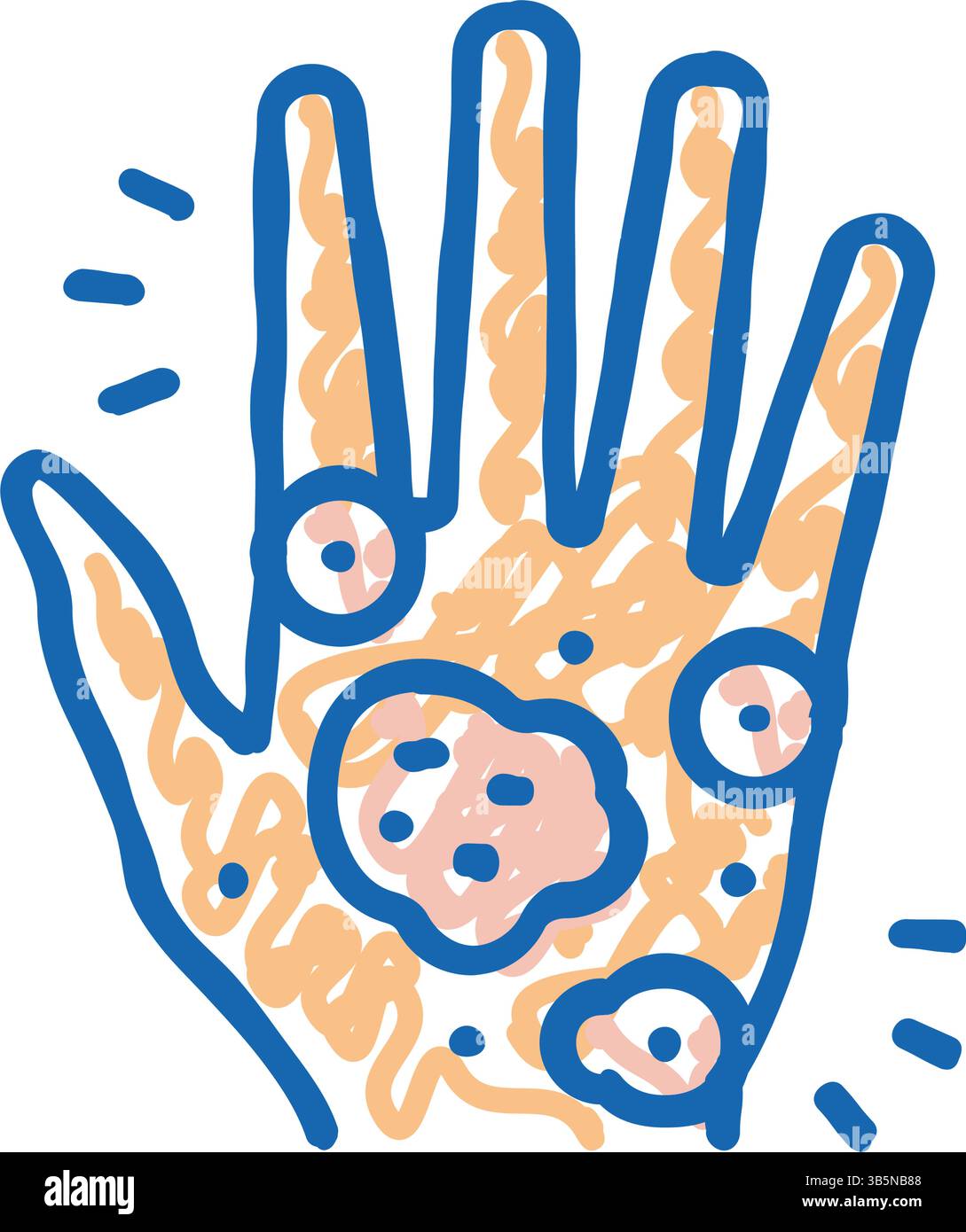 Pain eczema color icon Stock Vector Images - Alamy