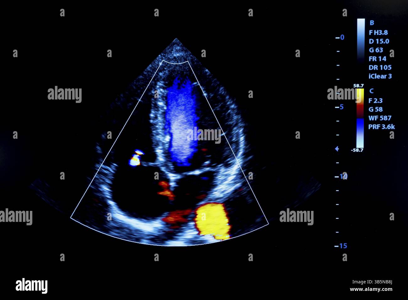 Colourful image of modern ultrasound monitor. Ultrasonography machine ...