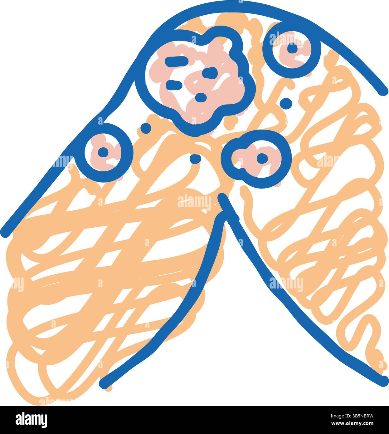 atopic dermatitis icon doodle illustration Stock Vector Image & Art - Alamy