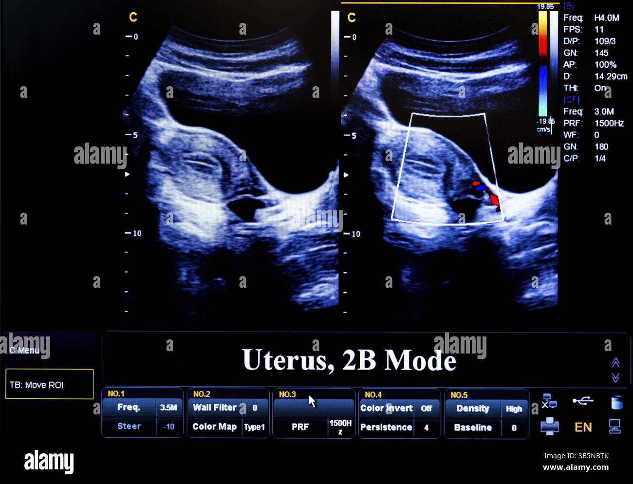 Modern echocardiography (ultrasound) machine monitor. Colour image. New ...
