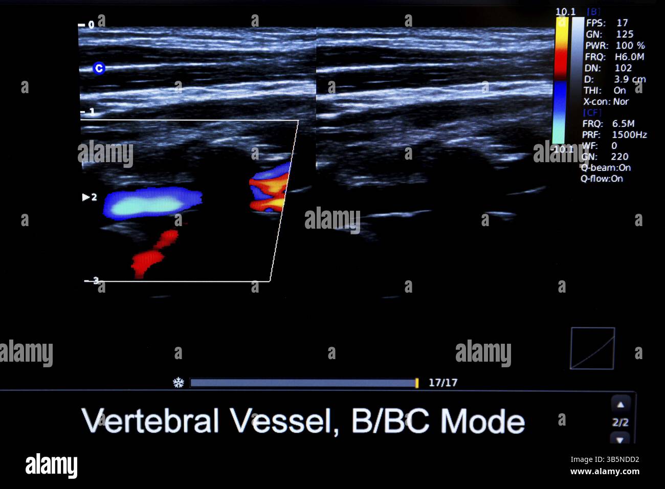 Colourful image of modern ultrasound monitor. Ultrasonography machine ...