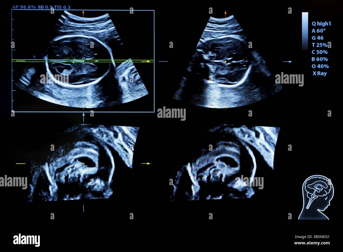 Colourful image of modern ultrasound monitor. Ultrasonography machine ...