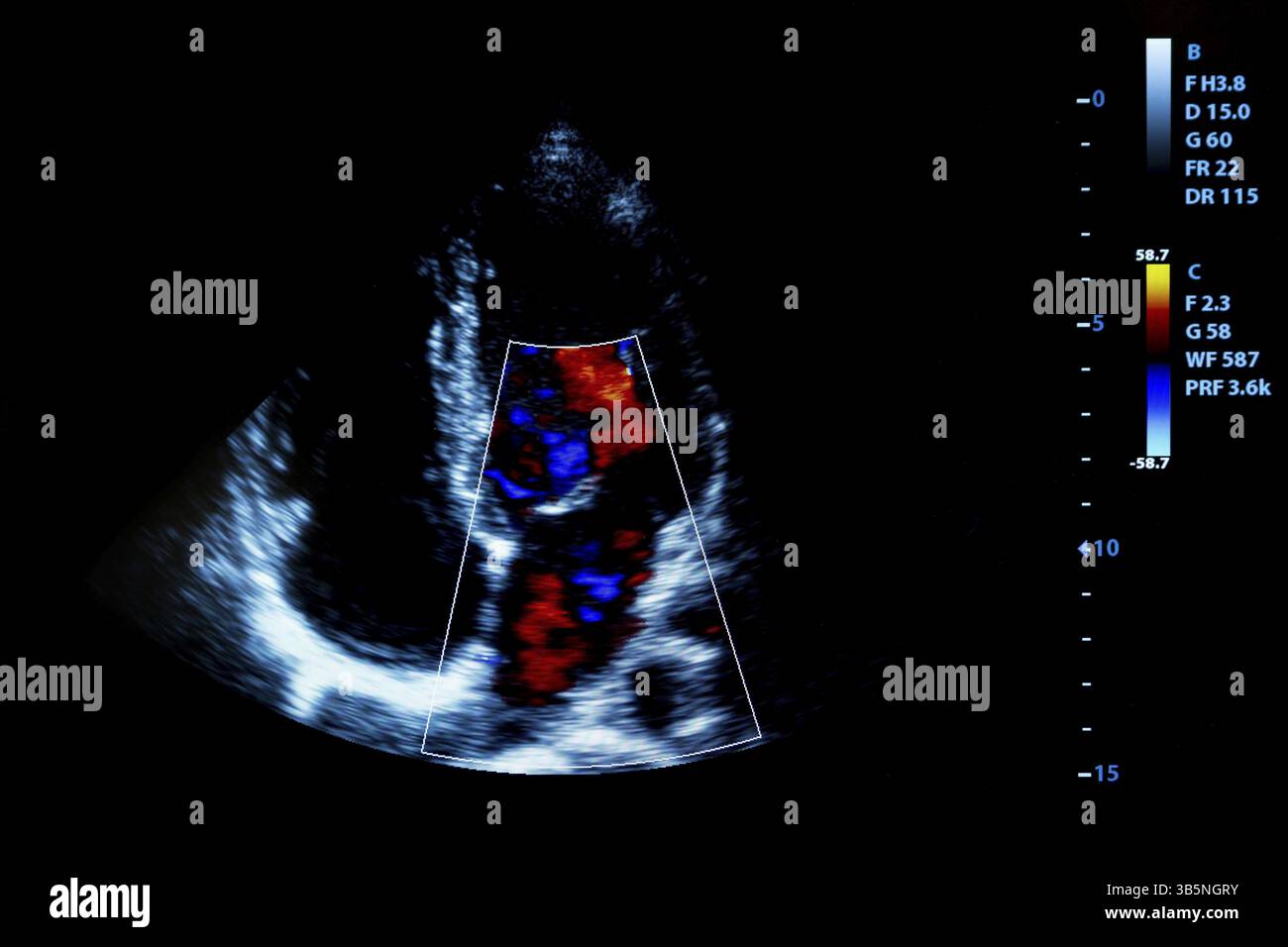 Colourful image of modern ultrasound monitor. Ultrasonography machine ...